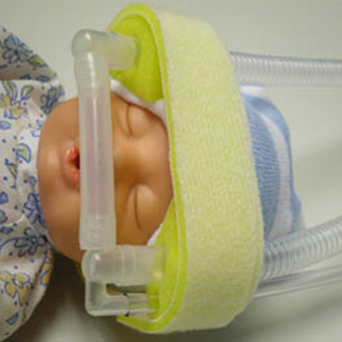 PRONG p/ CPAP Neonatal Newmed (pacote c/ 5 unidades) - Ref.: 52PRONG ...